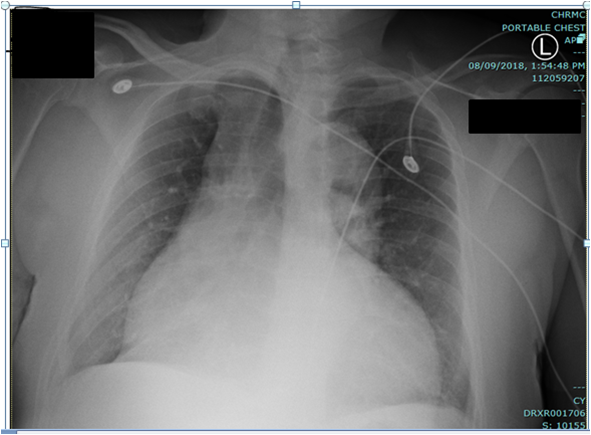 POST PARTY SYNDROME: OLD SYMPTOMS SHOULD ALWAYS BE REVISITED - SHM ...